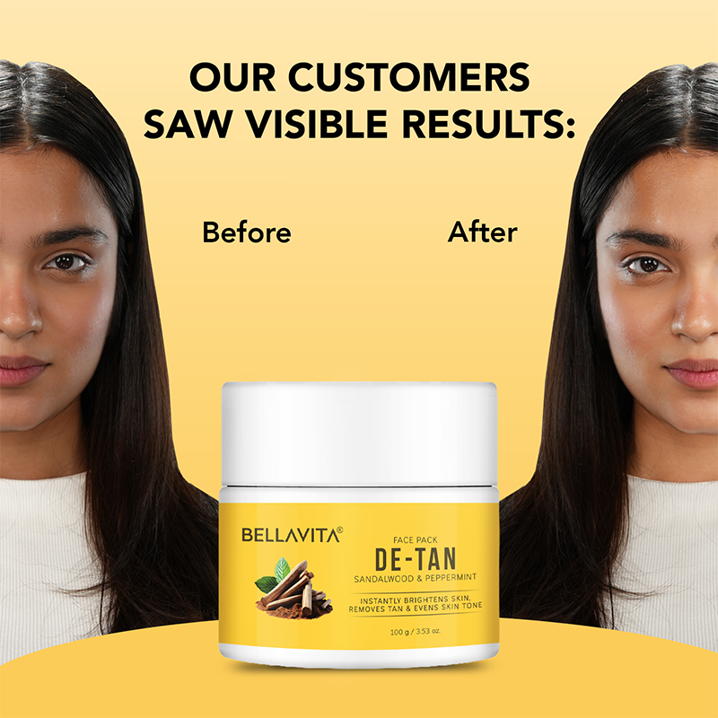 Buy Best De Tan Face Pack for Men and Women Online Under ₹400 in India ...